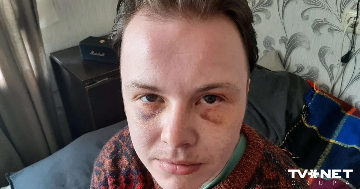 Tiesa piespriež bargāku sodu krimināllietā par Līvaja Amareina ...