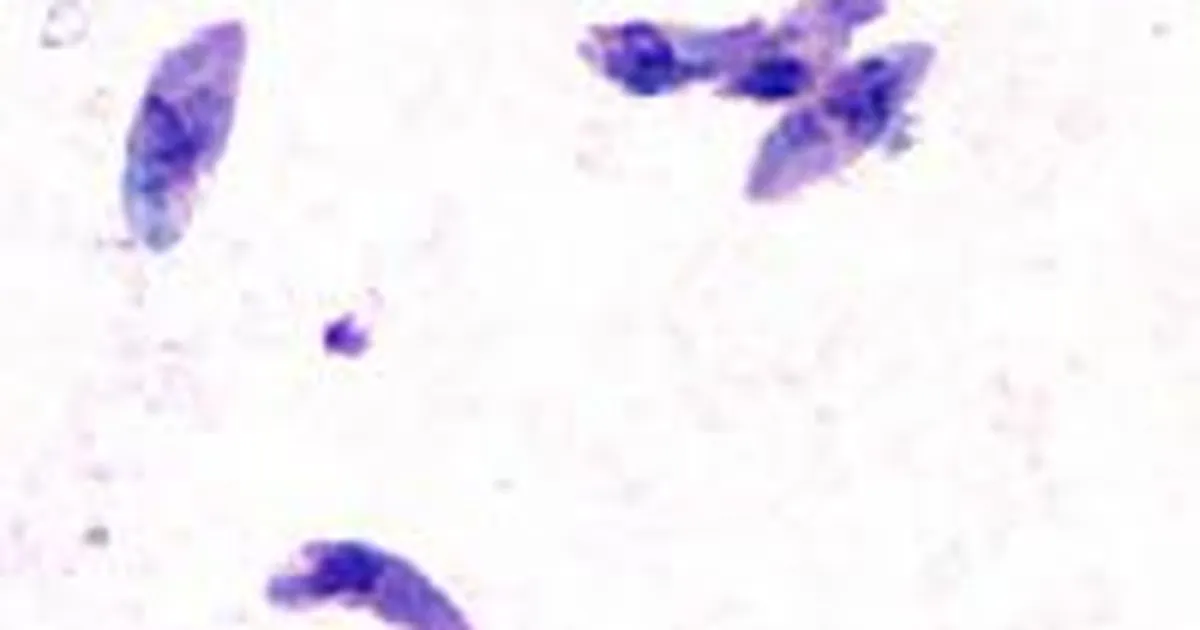 Parasiidid on välja suremas ja see on inimestele ohtlik