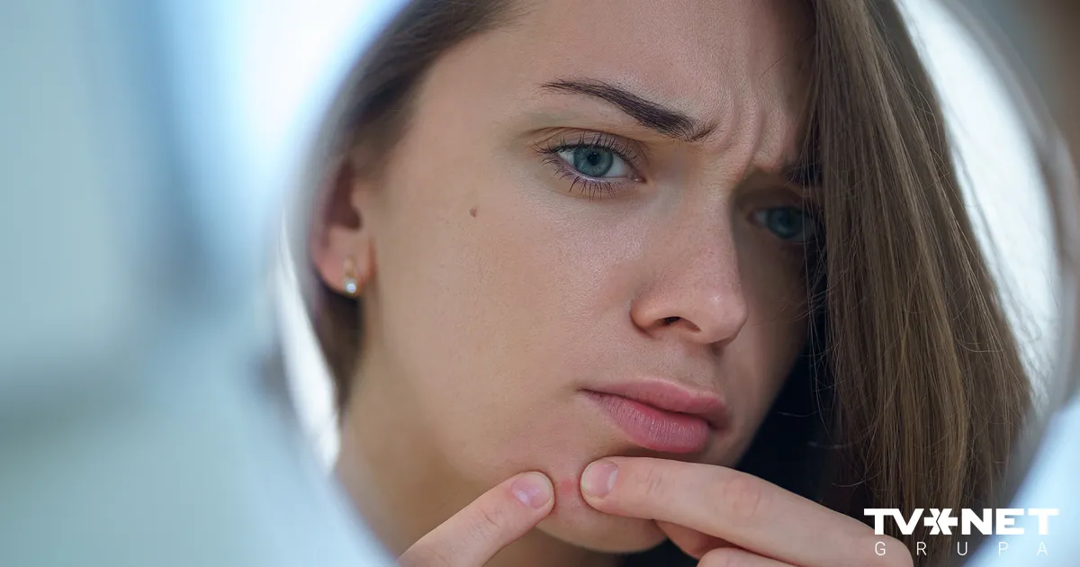 Ko darīt, ja pēkšņi uzmetusies pumpa: ātrais "glābšanas" plāns mājas apstākļos