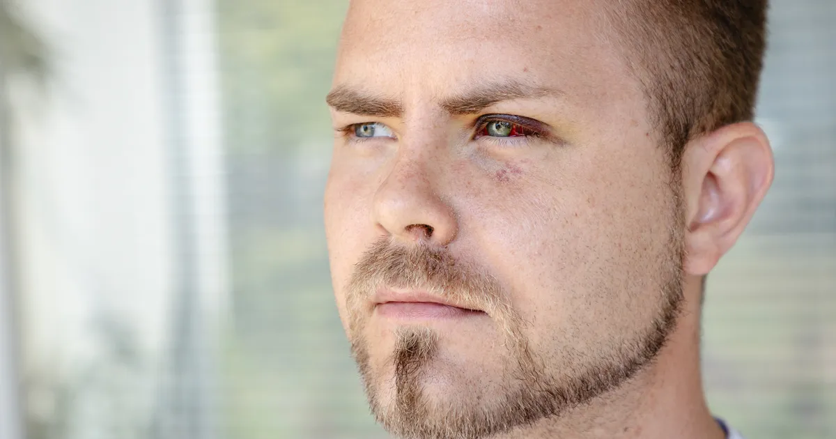 Kaks aastat tagasi Tallinnas rünnatud geipastor: pean tunnistama, et ...