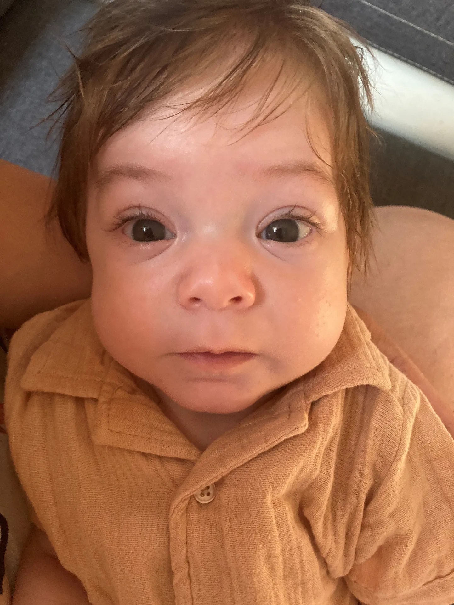 Üliharuldase ja karmi haigusega võitlev viiekuune Robin vajab ...