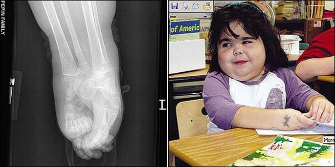 Shiloh Pepin X Ray